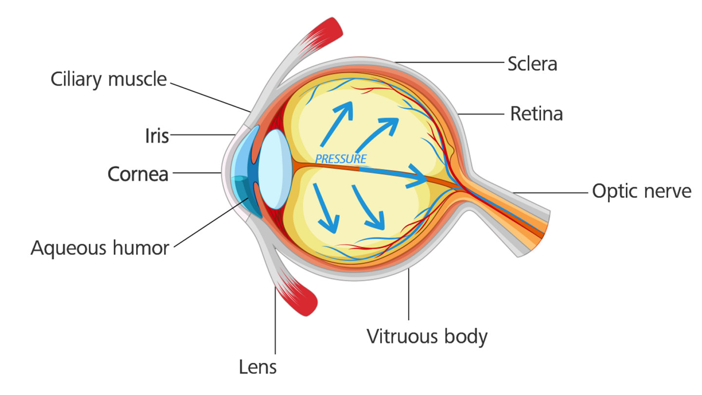 Glaucoma – all you need to know about the second leading cause of blindness